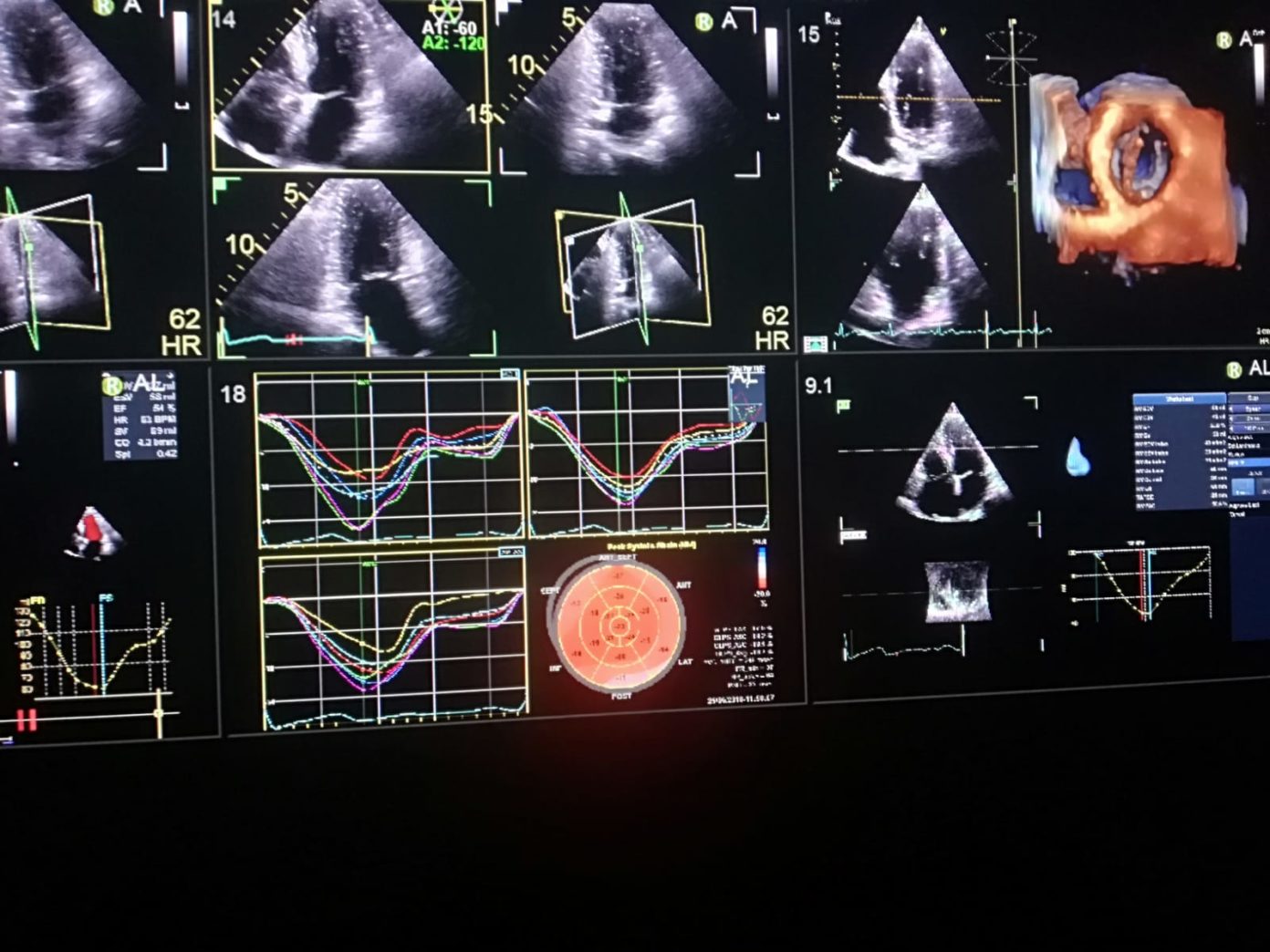 Cea mai avansată ecografie cardiacă, inclusiv pentru copii