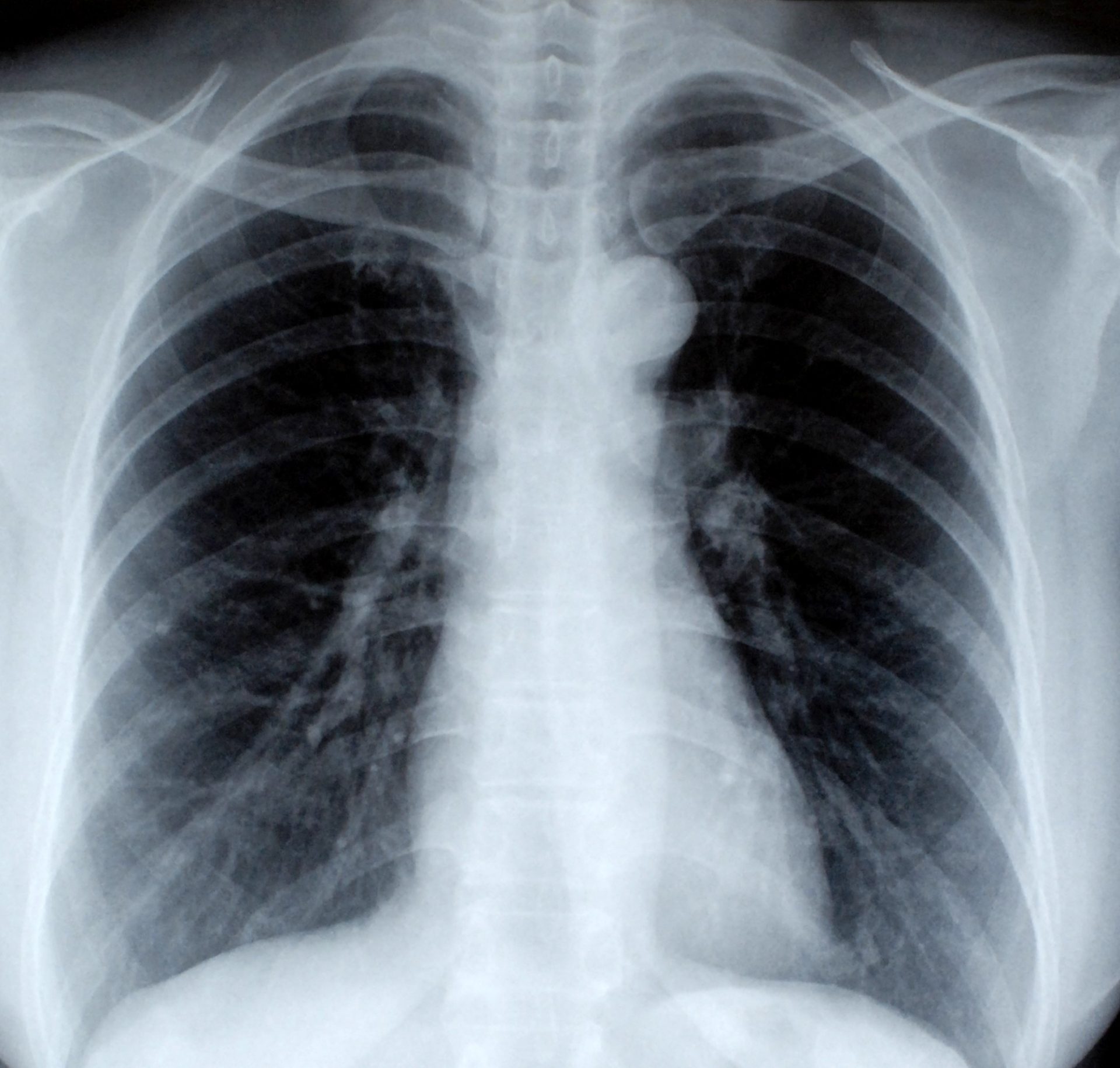 Aparate de radiologie mobilă la SJU Craiova. Unul va fi putea fi ...